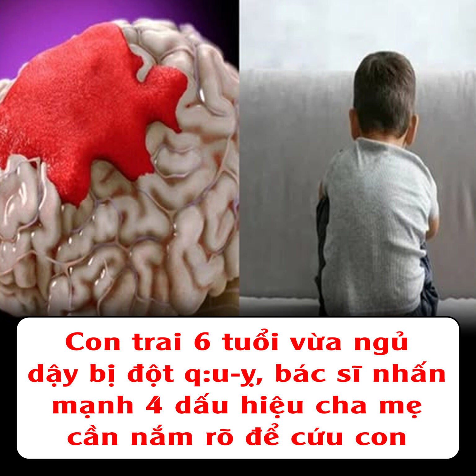 Con trai 6 tuổi vừa ngủ dậy bị đột q:u-ỵ, bác sĩ nhấn mạnh 4 dấu hiệu ...